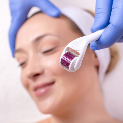 Microneedling in Helena, MT - Microneddling Near Me - APD